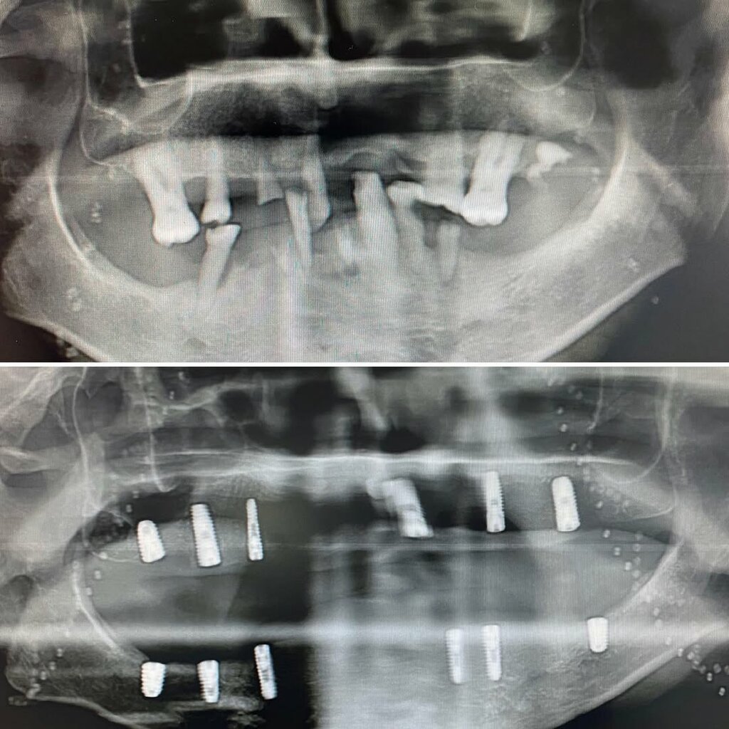 Özel ağız ve diş sağlığı klinikleri ve muayenehaneleri Özel Yaşam Diş Kliniği, Batman, foto