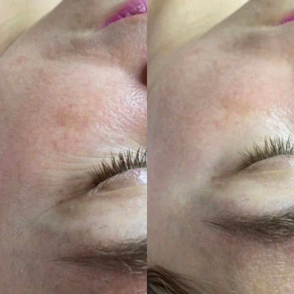 Kozmetoloji, kozmetik salonları Laser Pro, Stavropol, foto