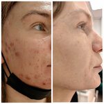 Салон эпиляции Smooth&Glow (Rusakovskaya Street No:4с1), epilasyon  Moskova'dan