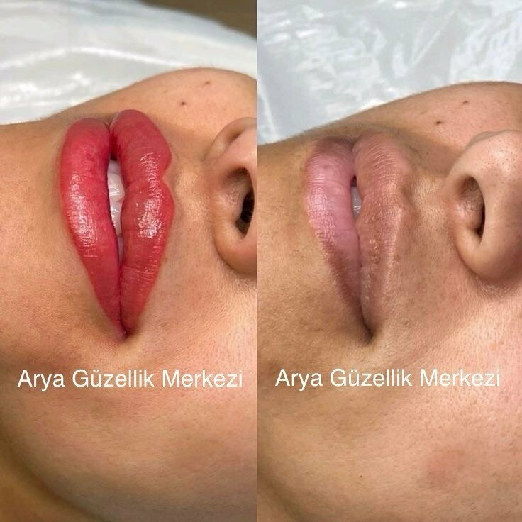 Spa Sivas Arya Güzellik Merkezi, Sivas, foto