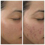 Cosmetology clinic Effect (Chistopolskaya Street No:79), kozmetoloji, kozmetik salonları  Kazan'dan