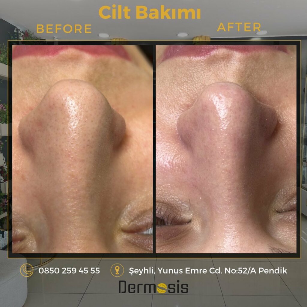 Güzellik salonu Dermosis Güzellik Salonu, İstanbul, foto