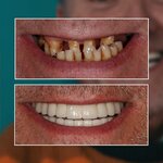 Lumos Dental Clinic (Antalya, Konyaaltı, Üniversite Cad., 5), özel ağız ve diş sağlığı klinikleri ve muayenehaneleri  Antalya'dan