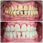 Batmaz Diş Kliniği (Ağrı, Doğubayazıt, Çiftepınar Mah., Refik Başkaya Cad., 114), özel ağız ve diş sağlığı klinikleri ve muayenehaneleri  Doğubayazıt'tan