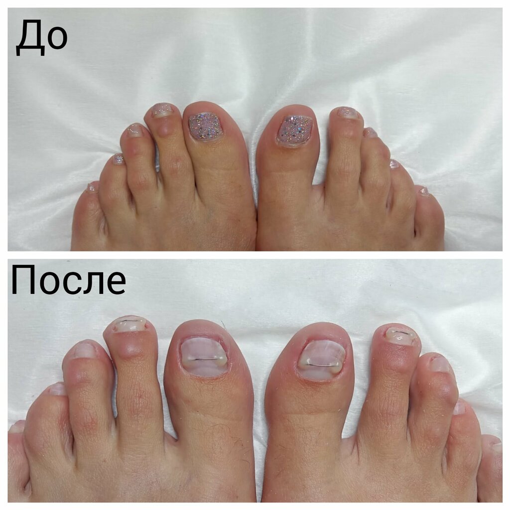 Podoloji Подолог Соловьева А., Moskova, foto