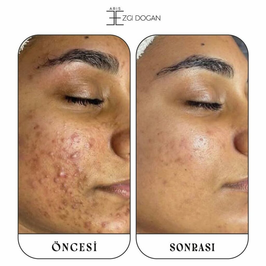 Güzellik salonu Aris Ezgi Doğan Manisa, İstanbul, foto