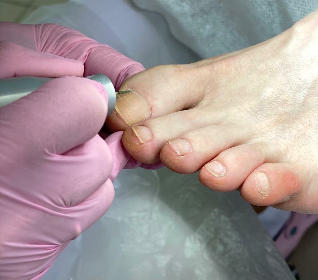 Podoloji Podospecific, Ulyanovsk, foto