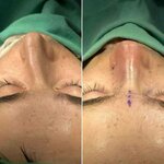 Op. Dr. Hüseyin Karabulut (İstanbul, Bakırköy, Çobançeşme E-5 Yan Yol Cad., 20B), özel muayenehaneler  İstanbul'dan
