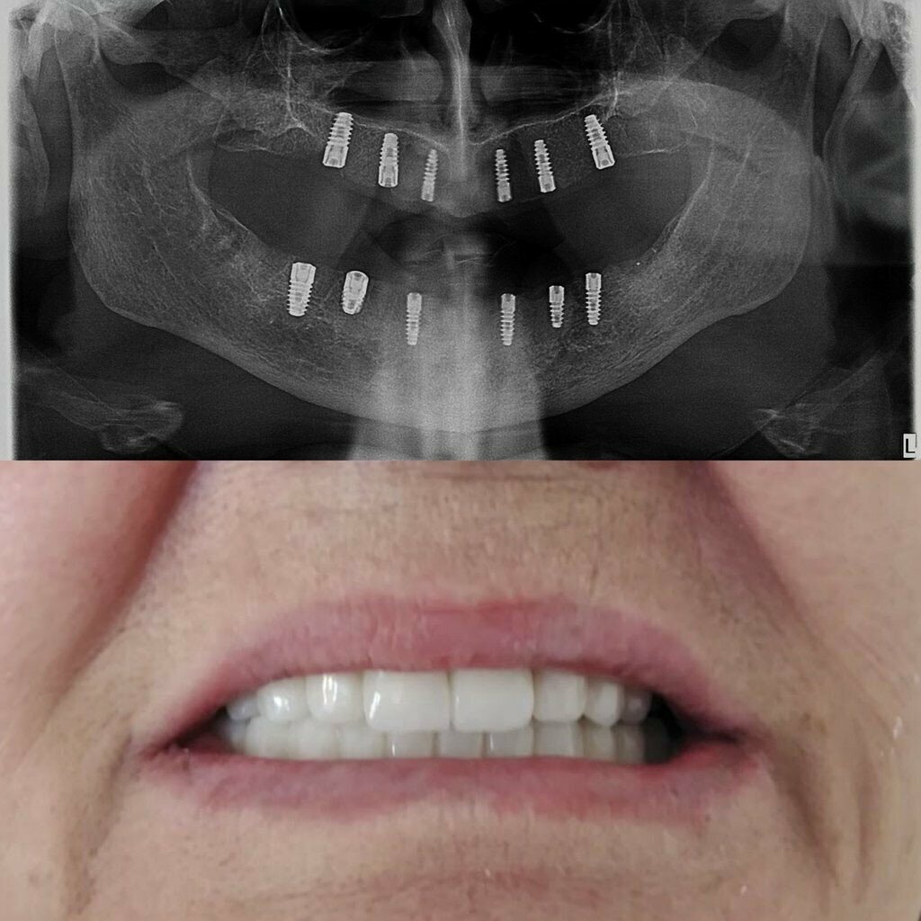 Özel ağız ve diş sağlığı klinikleri ve muayenehaneleri Diş Hekimi Mahmut Sarıgil, Ankara, foto