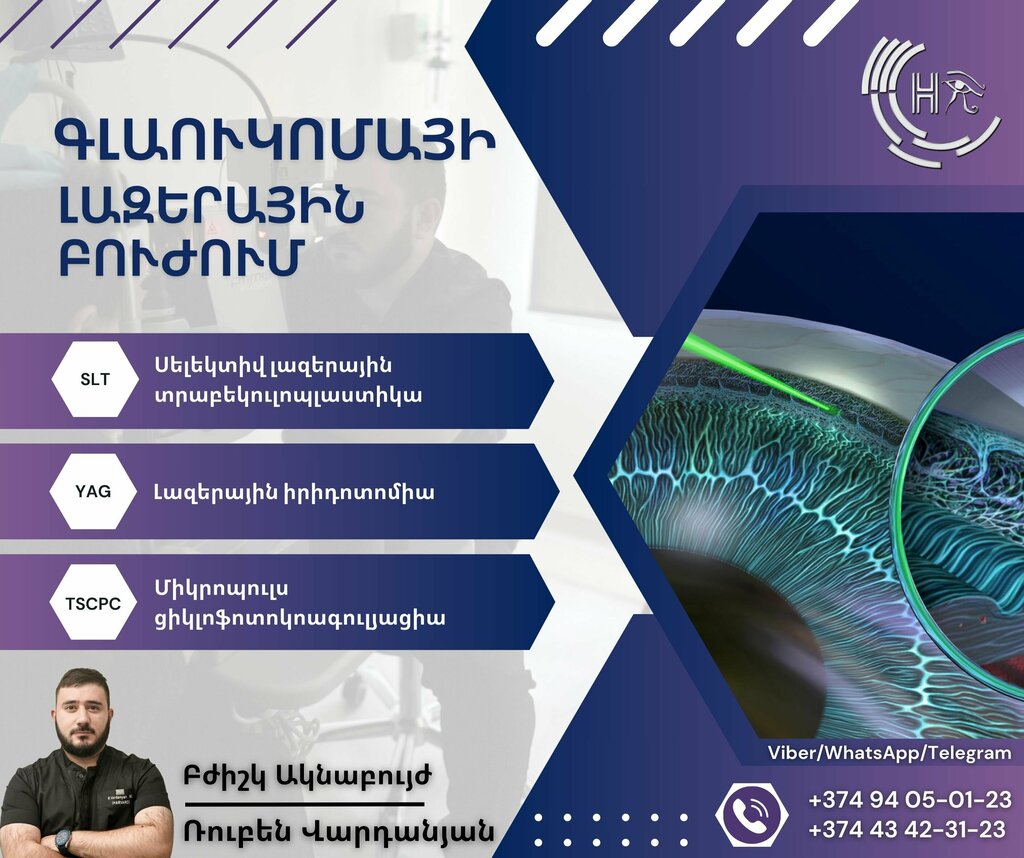 Göz sağlığı merkezleri Ռուբեն Վարդանյան, Erivan, foto