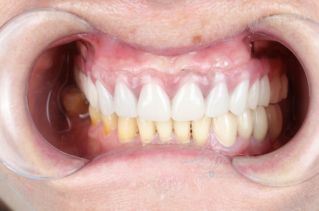 Özel muayenehaneler Dr. Mikael D. Aslanyan, Dmd, Dds, Erivan, foto