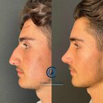 Op. Dr. Coşkun Özdemir - Burun Estetiği - Kulak Burun Boğaz Uzmanı (İstanbul, Kağıthane, Merkez Mah., Burcu Sok., 9), özel muayenehaneler  İstanbul'dan