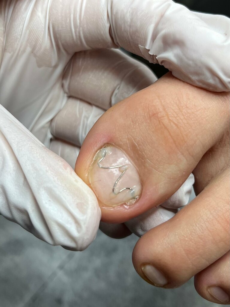 Podoloji Подолог, Orehovo‑Zuyevo, foto