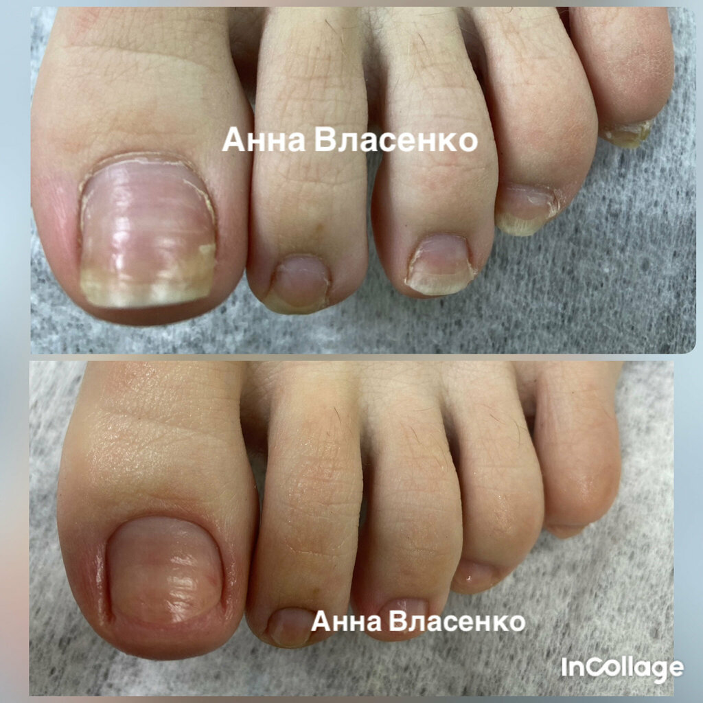 Podoloji Подолог-эстетист Власенко А. А., Krasnodarski krayı, foto