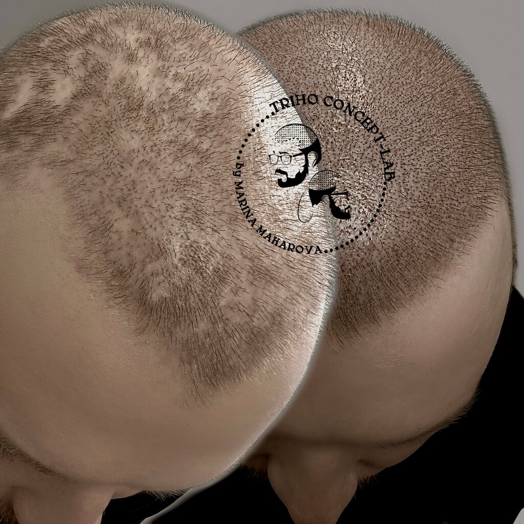 Kozmetoloji, kozmetik salonları Triho Concept-lab, Moskova, foto