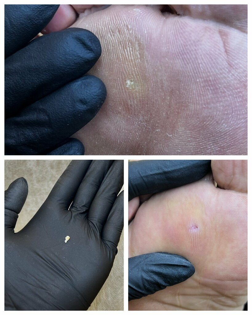 Manikür-pedikür Кабинет подолога Инны Мамаевой, Moskova, foto