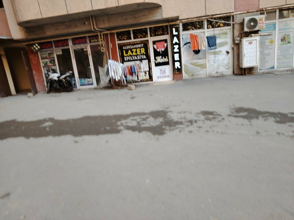 Epilasyon Lazer, Bakü, foto