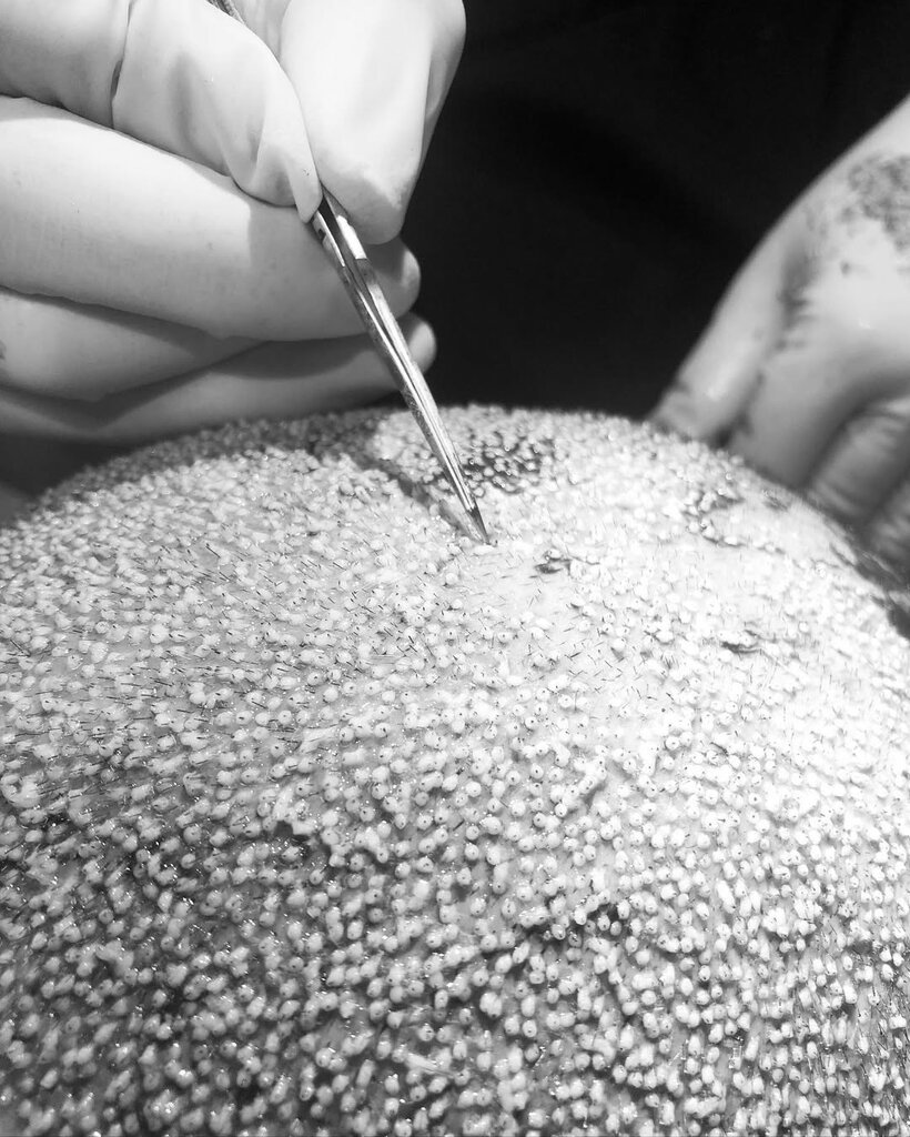 Tıp merkezleri ve klinikler Diamond Hair Center, İstanbul, foto