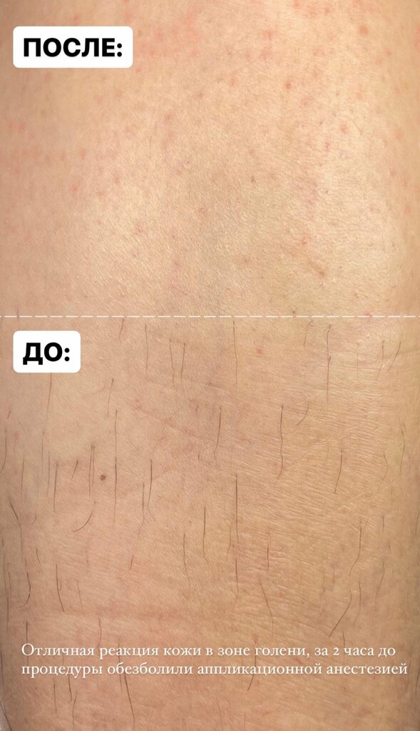 Epilasyon Студия электроэпиляции, Saint‑Petersburg, foto