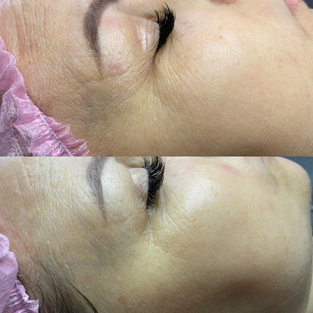 Kozmetoloji, kozmetik salonları Poyarkova_beauty, Saint‑Petersburg, foto