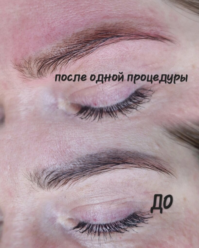 Güzellik salonu Студия удаления тату и перманентного макияжа, Mejdureçensk, foto