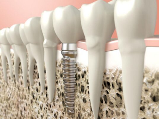 Özel ağız ve diş sağlığı klinikleri ve muayenehaneleri Solani Dr. Vincenzo Studio Dentistico, Umbria, foto