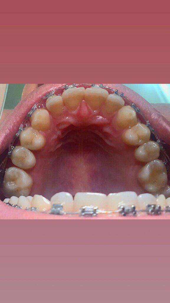 Özel ağız ve diş sağlığı klinikleri ve muayenehaneleri Стоматология Азизбека Ботирова, Taşkent, foto