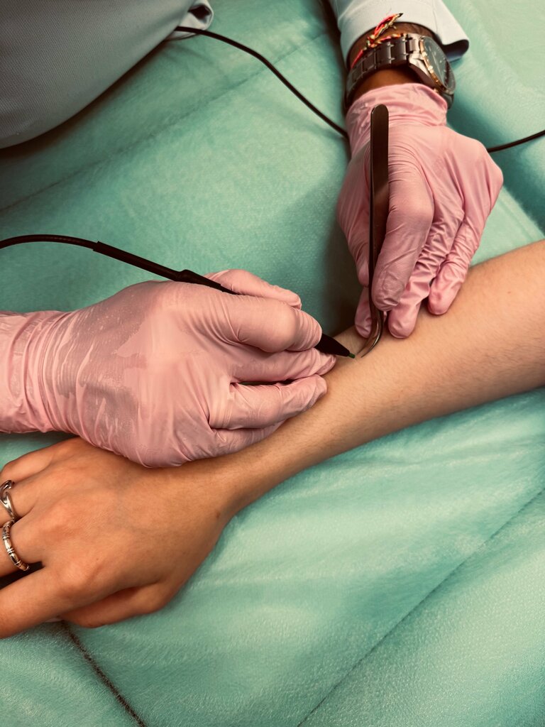 Epilasyon Электролог-эстетист Тыщенко Е. А., Saint‑Petersburg, foto