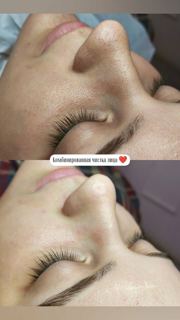 Kozmetoloji, kozmetik salonları Uchaeva Cosm, Pugaçov, foto