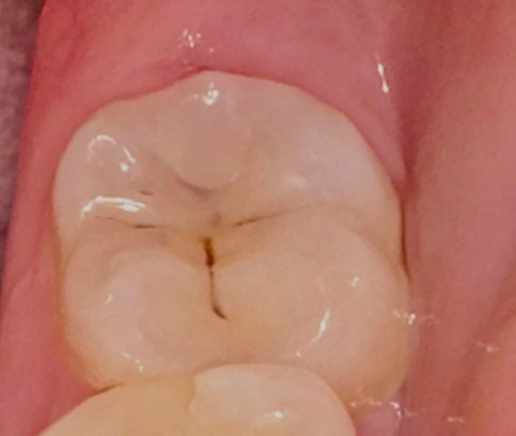 Diş sağlığı poliklinikleri Белореченская стоматологическая поликлиника, Beloreçensk, foto