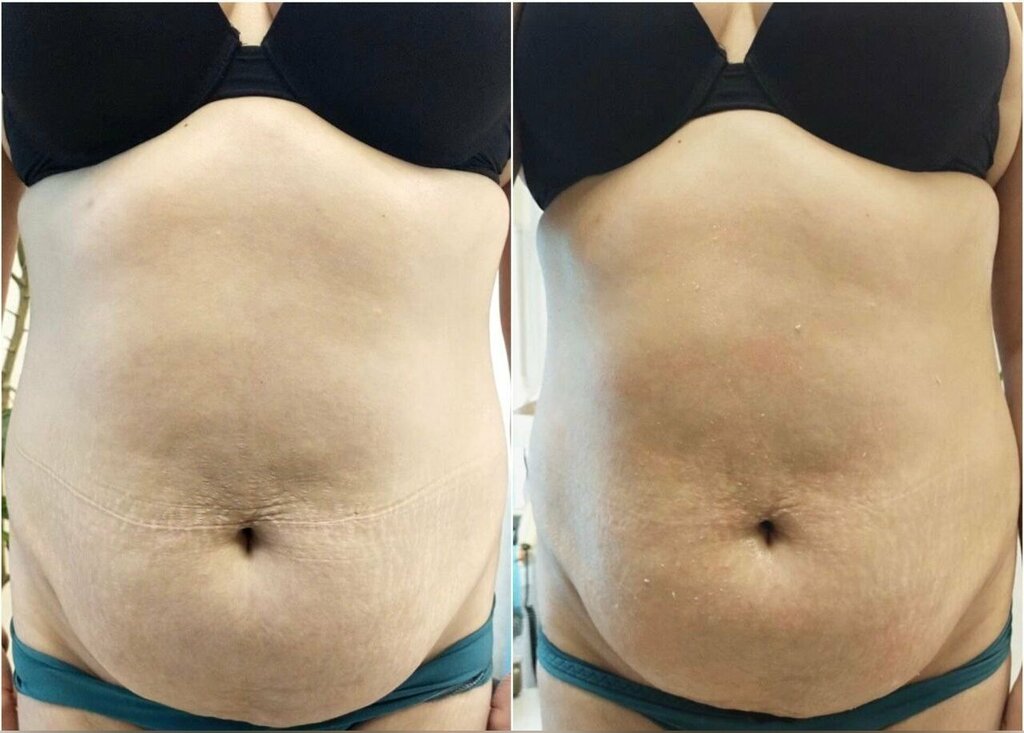 Kozmetoloji, kozmetik salonları Estetik Plasma, Nijnevartovsk, foto