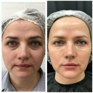 ТалассоКосметолог шугаринг Якимова Н. А. (Serova Street No:99А), kozmetoloji, kozmetik salonları  Izhevsk'ten