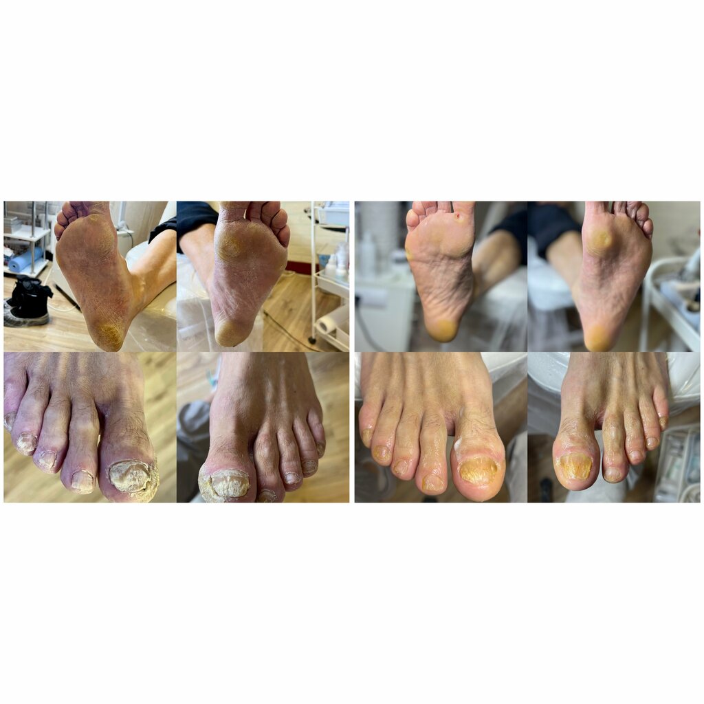 Podoloji Podo Help, Nijegorodskaya oblastı, foto