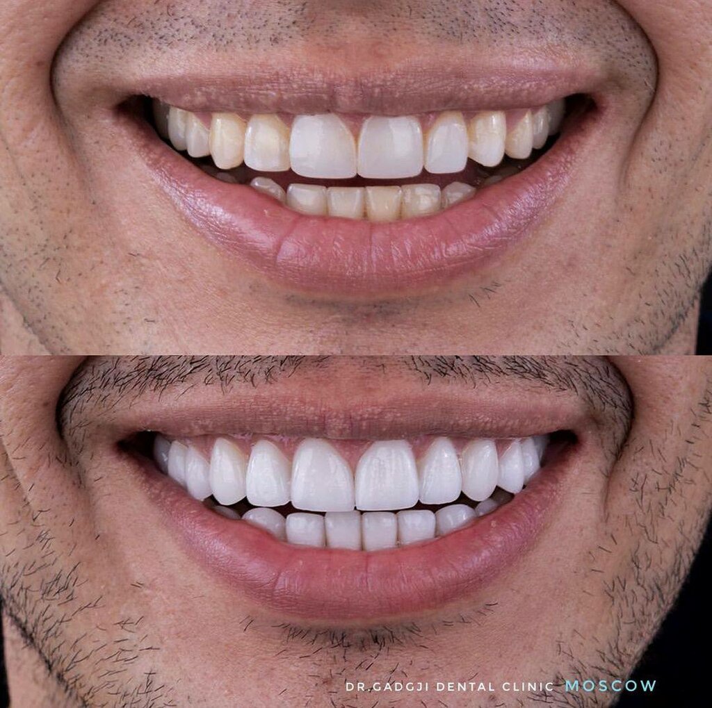 Özel ağız ve diş sağlığı klinikleri ve muayenehaneleri Estet Dental, Armavir, foto