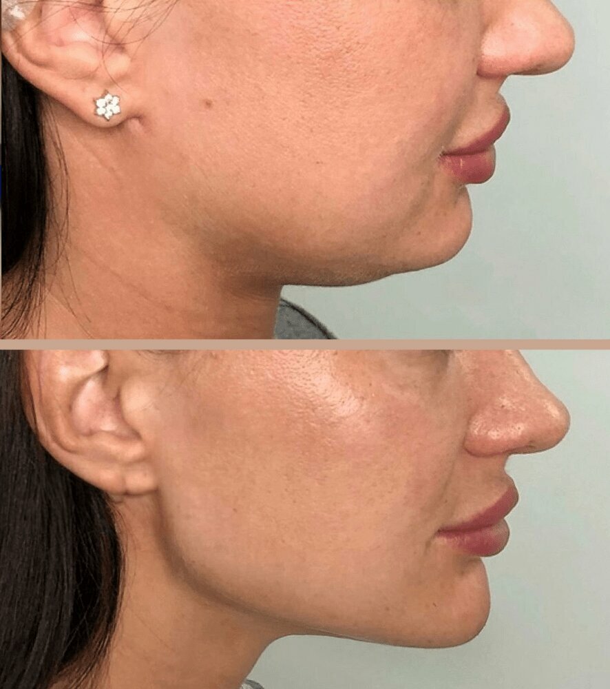 Kozmetoloji, kozmetik salonları Aesthetic Expert, clinic, Dubai, foto