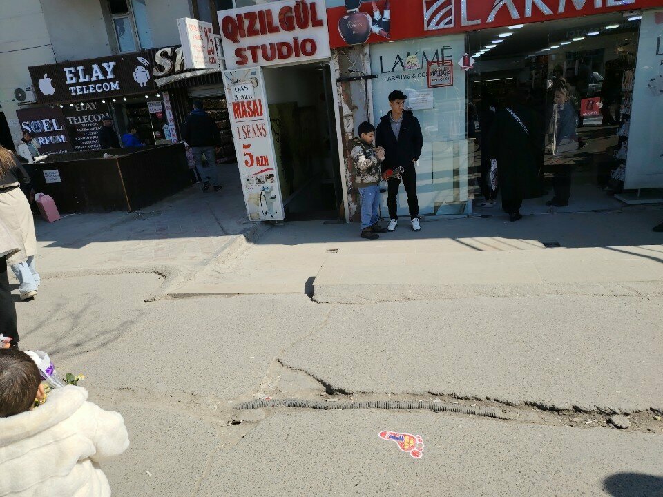 Epilasyon Qızıl gül studio, Bakü, foto