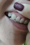Stoma pro (No:41, Yashnabad City District, Aviasozlar Shaharchasi, 4-mavze), özel ağız ve diş sağlığı klinikleri ve muayenehaneleri  Taşkent'ten