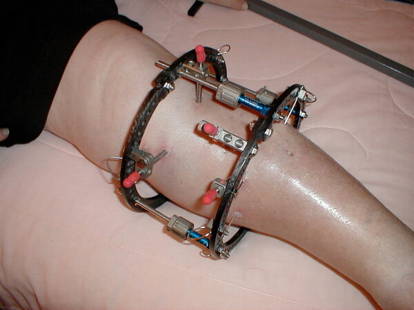 Avukatlar Rosenfeld Injury Lawyers LLC, Chicago, foto