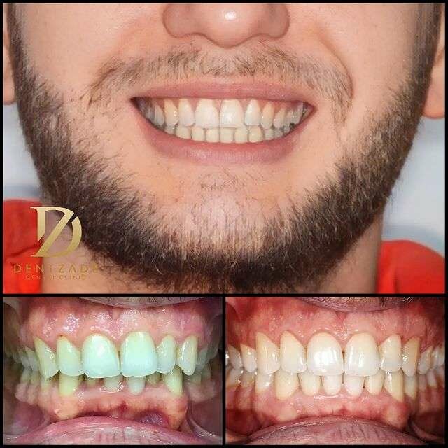 Özel muayenehaneler Dt. Mehmet Nuri Yüksek Implant Uzmanı Kozmetik Diş Hekimi, İstanbul, foto