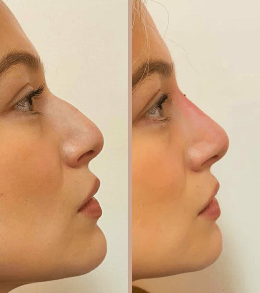 Kozmetoloji, kozmetik salonları Aesthetic Expert, clinic, Dubai, foto