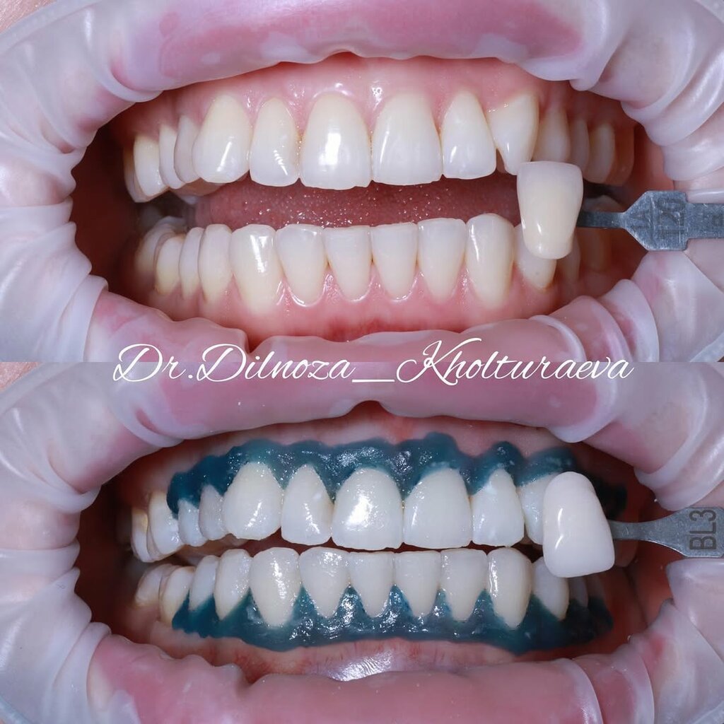 Özel ağız ve diş sağlığı klinikleri ve muayenehaneleri Korona Dentis, Taşkent, foto