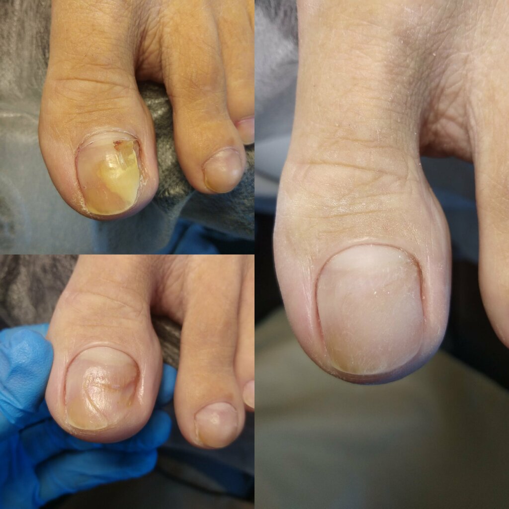 Podoloji Podomax, Nijegorodskaya oblastı, foto