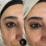 Nesli'Ce Clinic (Kırıkkale, Kırıkkale Merkez, Yenidoğan Mah., 608. Sok., 7), güzellik salonu  Kırıkkale'den