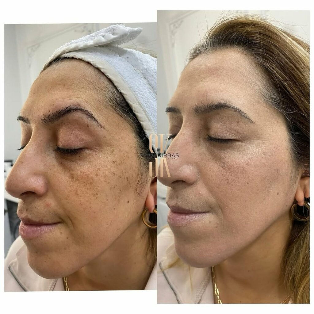 Tıp merkezleri ve klinikler Pia Beauty Güzellik Merkezi, İstanbul, foto