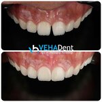 Vehadent Ağız ve Diş Sağlığı Polikliniği (Kahramanmaraş, Onikişubat, Alparslan Türkeş Blv., 8C), özel ağız ve diş sağlığı klinikleri ve muayenehaneleri  Kahramanmaraş'tan