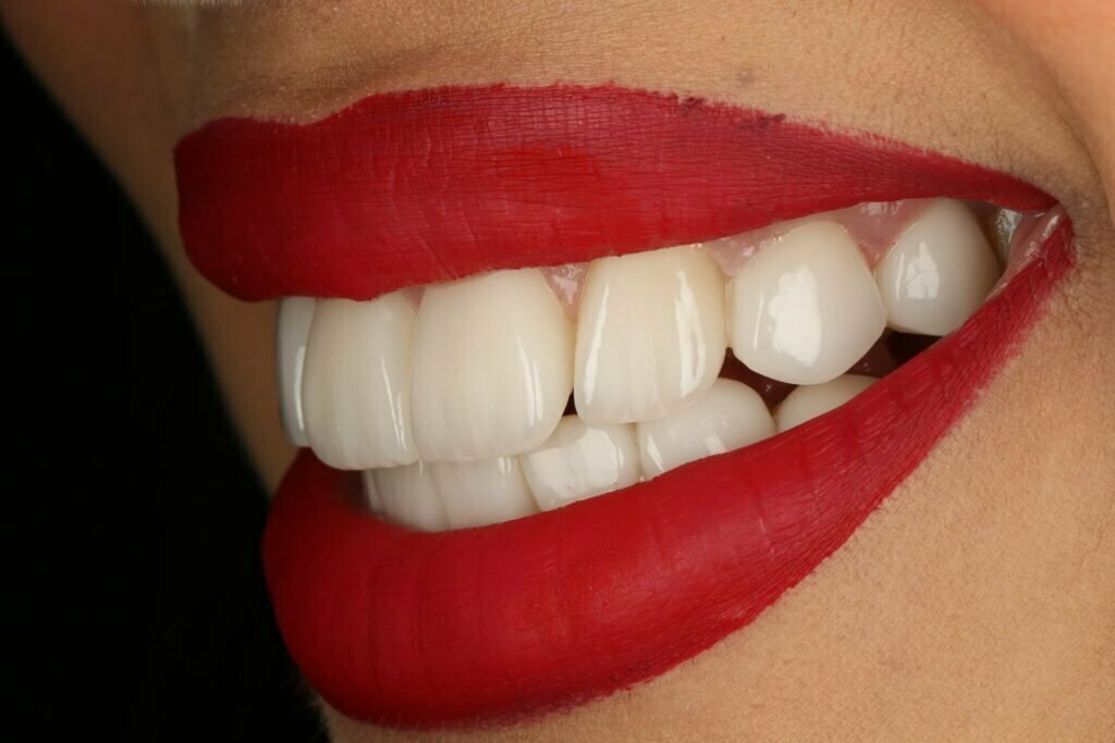 Özel ağız ve diş sağlığı klinikleri ve muayenehaneleri Zoe Dental Clinic, Dubai, foto
