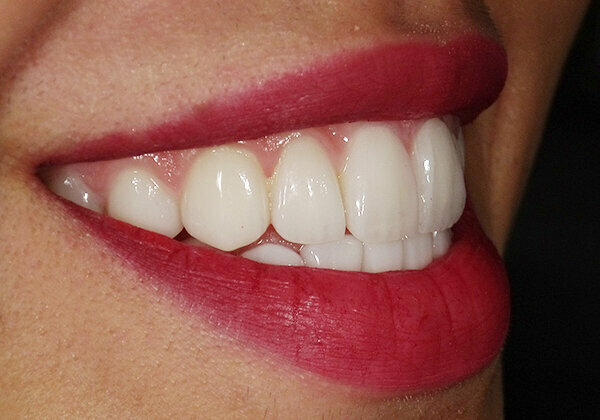 Özel ağız ve diş sağlığı klinikleri ve muayenehaneleri Al Luluah Al Baidhaa Dental Clinic, Sharjah, foto