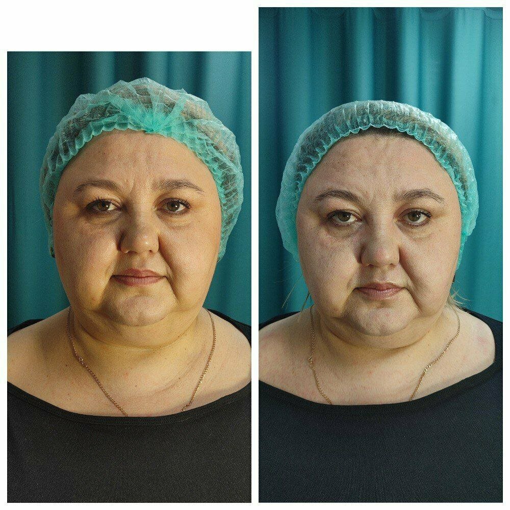 Kozmetoloji, kozmetik salonları Орхидея, Himki, foto