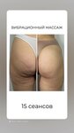 Slim Estetic (Bol'shaya Pokrovskaya Street No:93Б), kozmetoloji, kozmetik salonları  Nijni Novgorod'dan