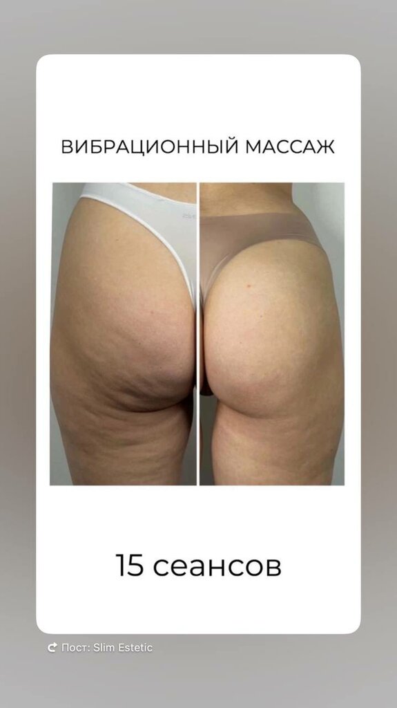 Kozmetoloji, kozmetik salonları Slim Estetic, Nijni Novgorod, foto